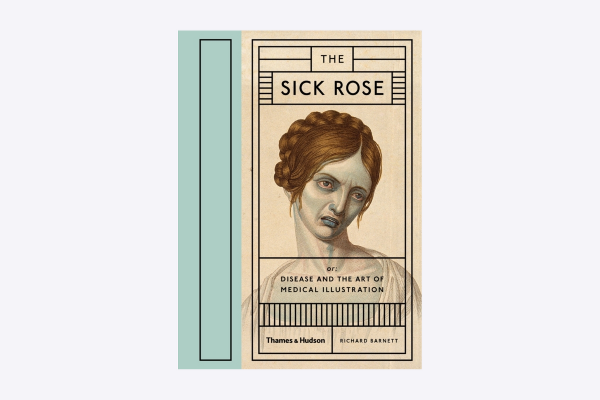 The Sick Rose – Thackray Museum of Medicine